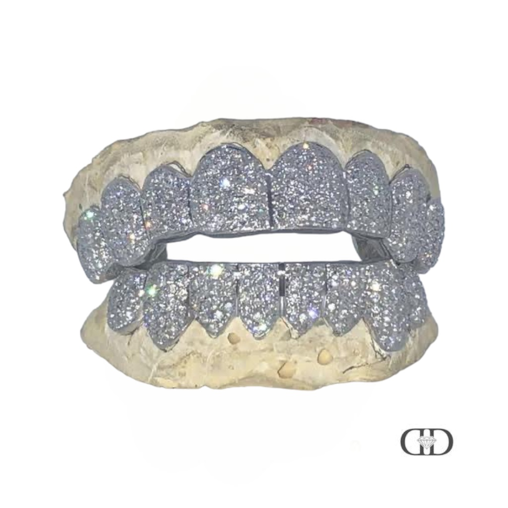 Customize 14K 18K White Yellow Gold Diamond Custom Grills Near Boston ...