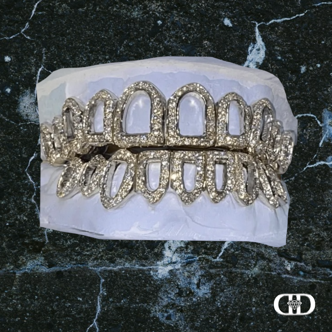 Bespoke Vip 14k Yellow Gold Open Face Diamond Grill – Danny Diamonds & Co
